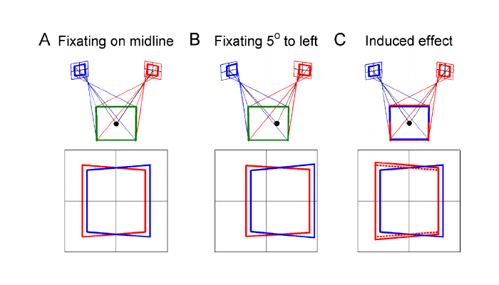 What Is Fronto Parallel? What You Need to Know